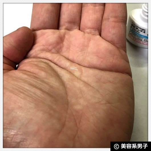 【ニキビ予防/治療薬】新薬 ゼビアックス ローション2% 効果と塗り方