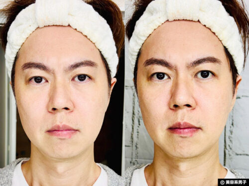 【試してみた】湘南美容デカ目薬「SBCアイブースター」効果口コミ